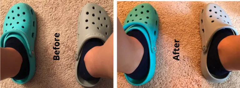 How to Shrink Crocs If They Are Too Big? ( 5 Easy Steps) | WearDuke